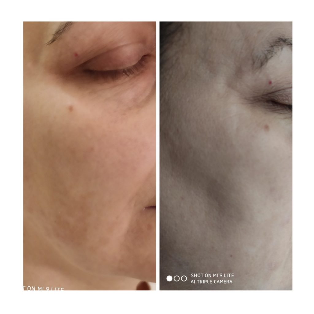 Gallery – Best Facial Treatments Marylebone – Semper Iuvenis Aesthetics